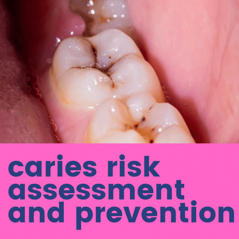 Caries Risk Assessment and Prevention